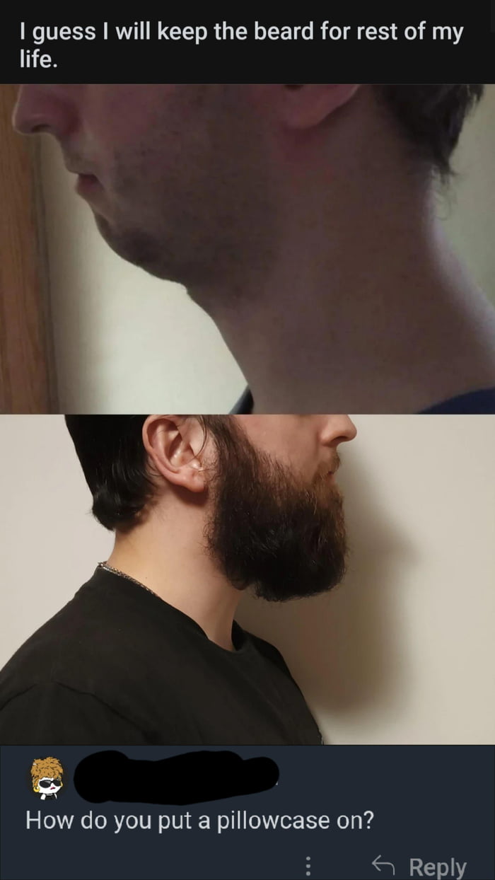 Keep your chin up - 9GAG