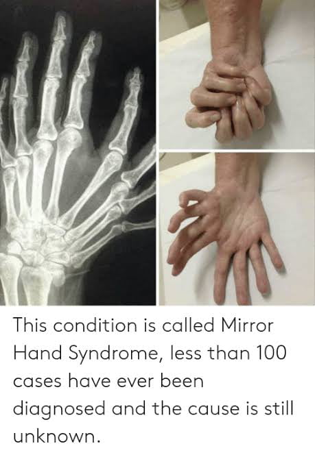 Mirror hand, protector of Chernobyl, abhorrent horror. - 9GAG