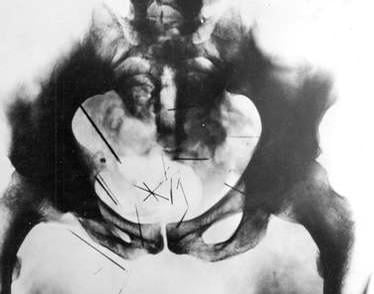 Hamilton Howard "Albert" Fish was an American serial killer and ...