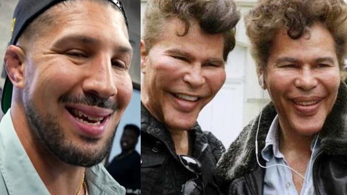 Botox Brother Triplets of Injected Narcissism - 9GAG