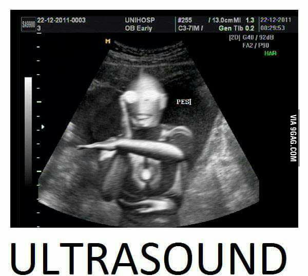 ULTRACEPTION - 9GAG