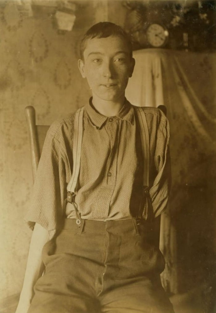 16 year old spring factory worker. He lost his arm and leg in an ...