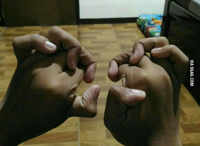 To the guy who posted about the guy who posted about his weird thumb - 9GAG