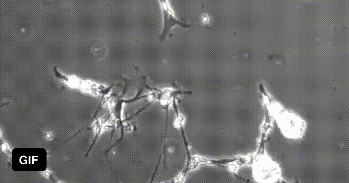 Fetal neurons making connections - 9GAG