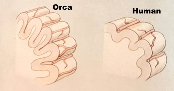 Fun thing to think about - our brains are smoother than an Orca brain ...