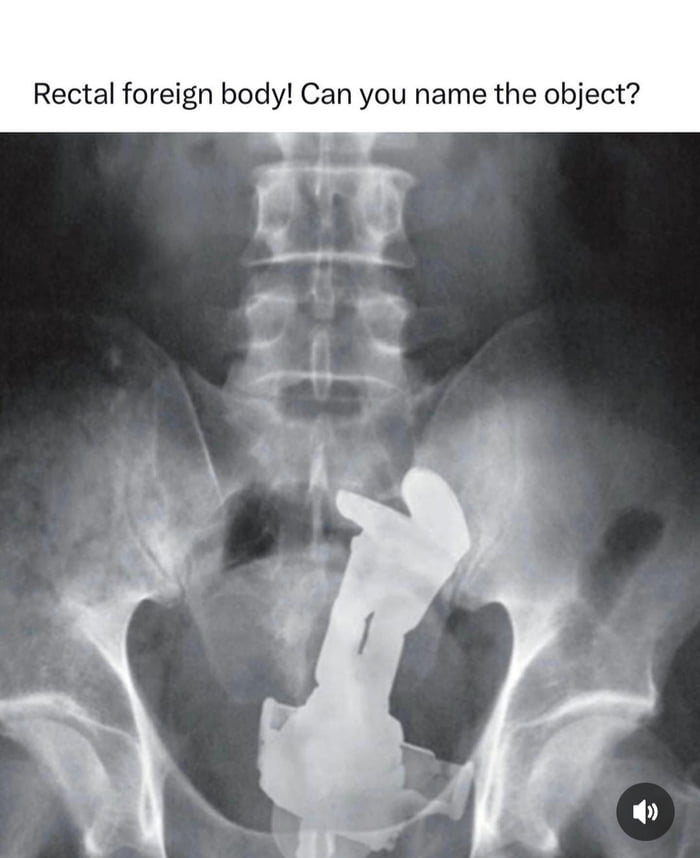 Guess who's that.... (disregard the volume button) - 9GAG