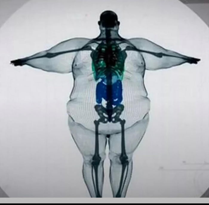 Zion williamson’s X-ray results - 9GAG