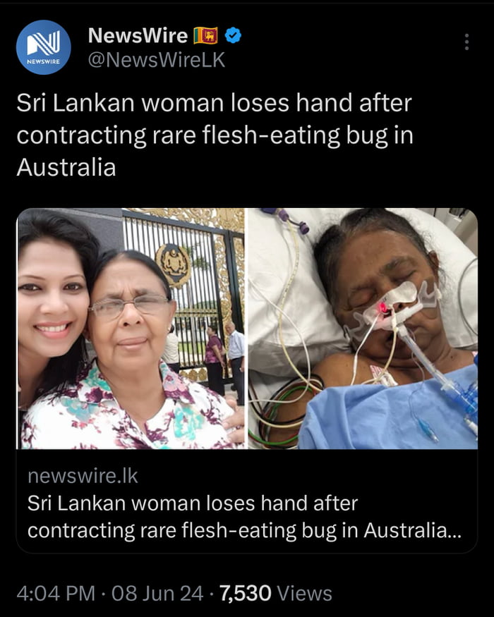 Of course it's Australia - 9GAG