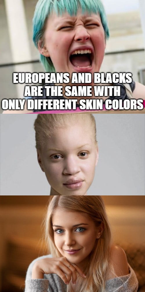 Maybe they have the same skull shape and structure. - 9GAG