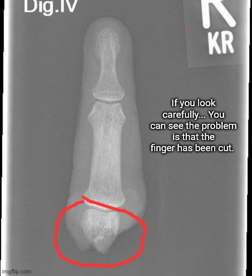 Good think we caught that in the X-ray. - 9GAG