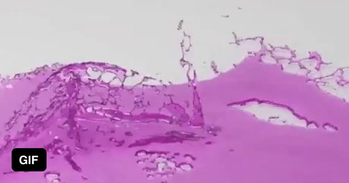 Reversed GIFs are awesome - 9GAG