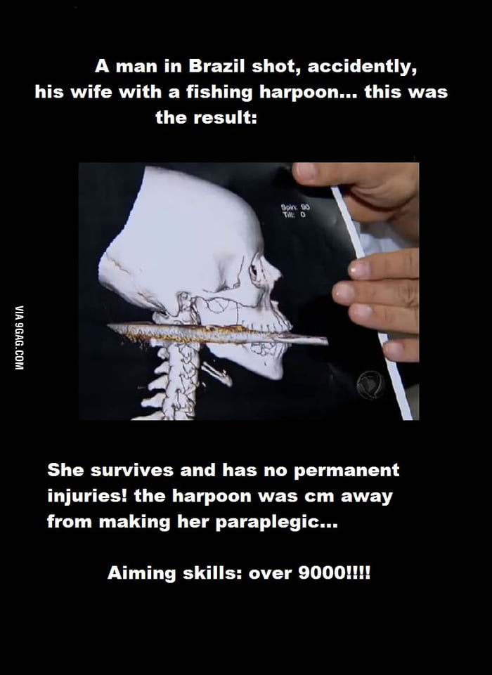 Lucky level: 9000 - 9GAG