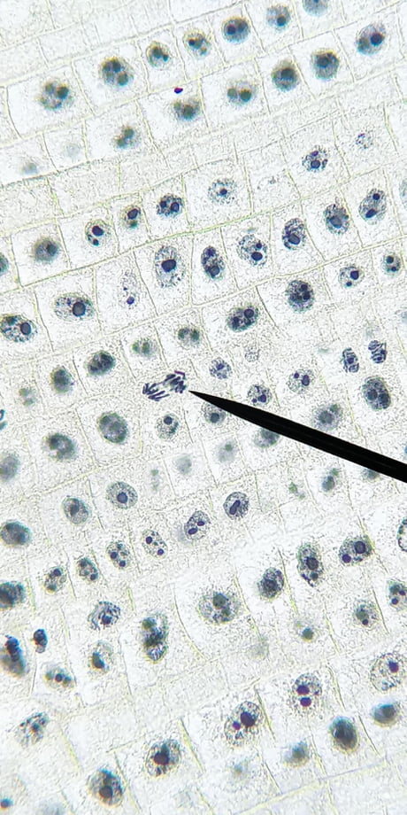 Mitosis Under Microscope Labeled Micropedia