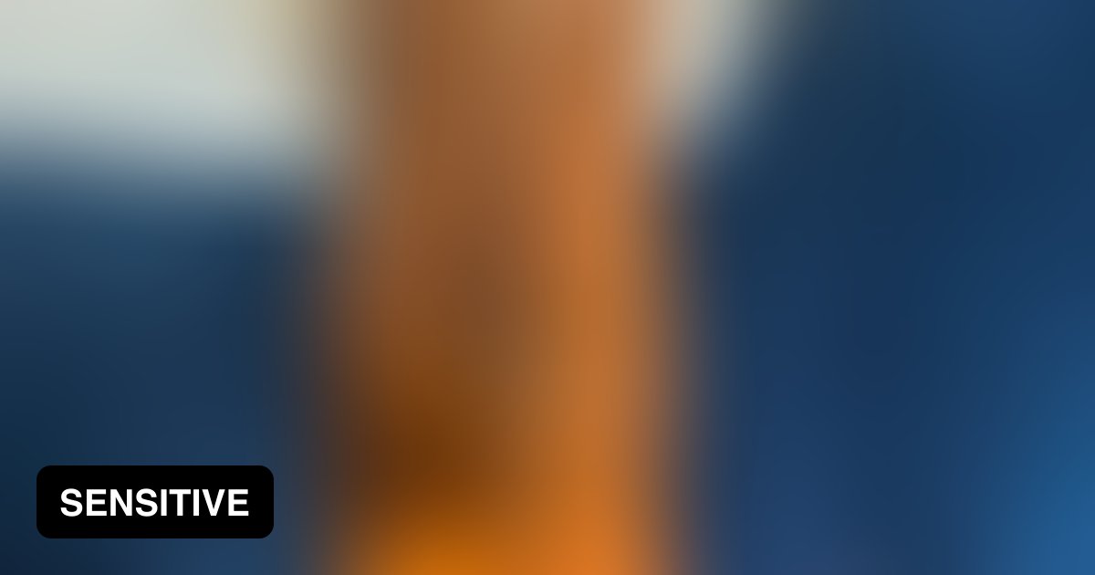 Presnel Kimpembe shows the reality of his most recent injury. He ...