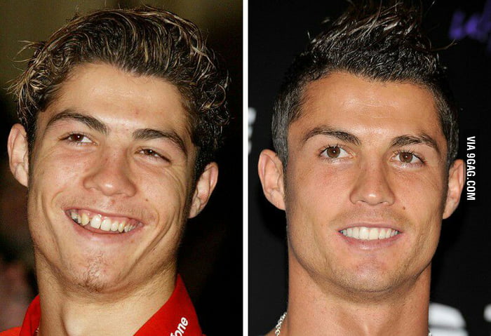 It's amazing how fixing your teeth can change your face ($) - 9GAG