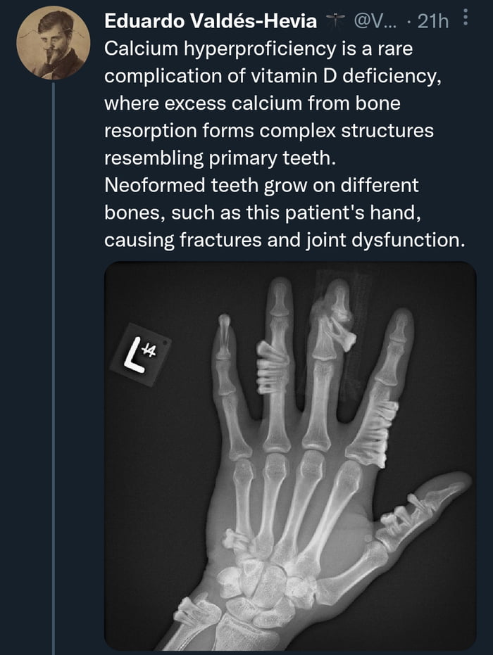 *screams internally* - 9GAG