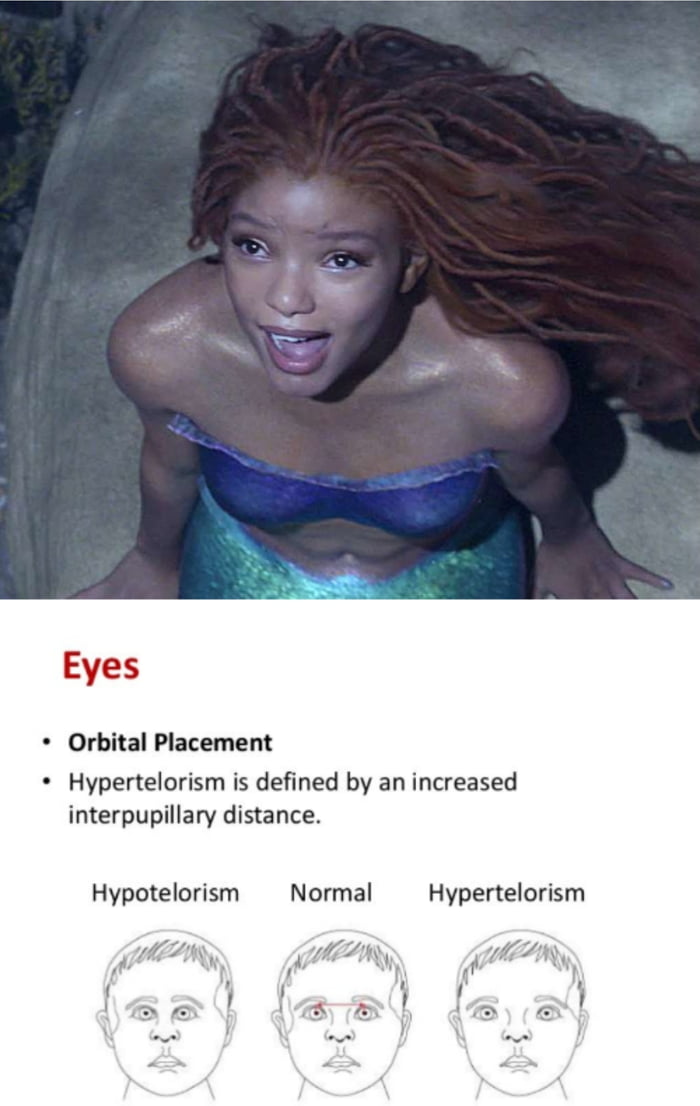 It's been bugging me so I looked it up - 9GAG