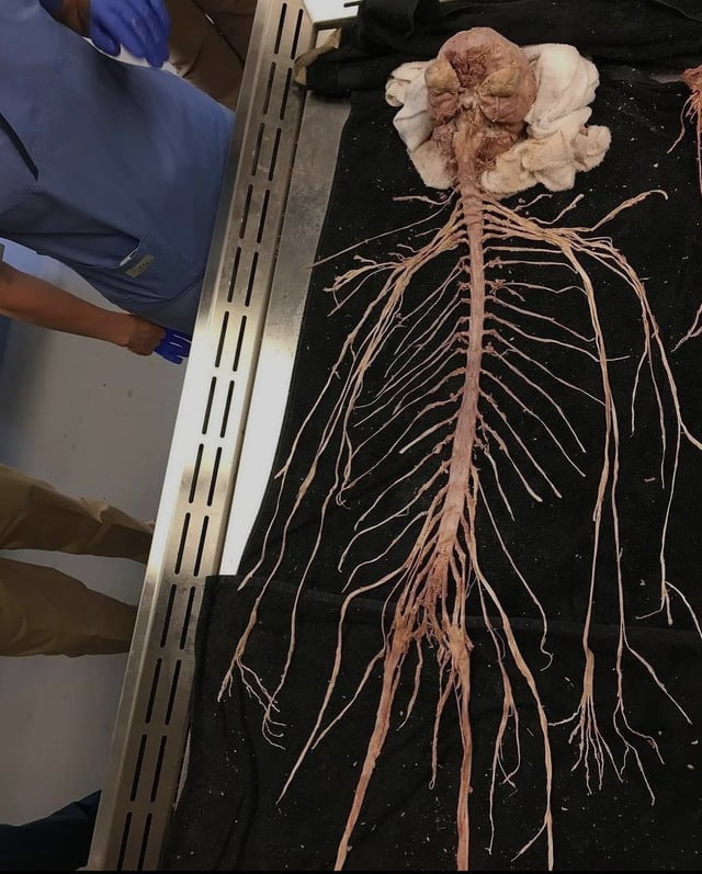 A Fully intact human nervous system - 9GAG