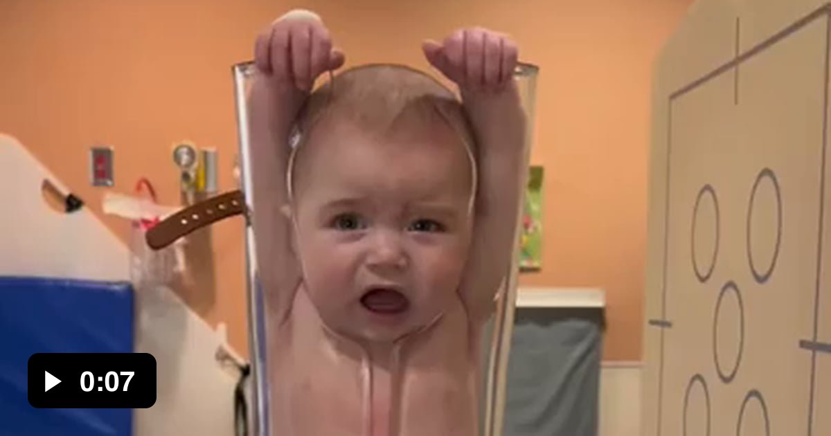 In case you ever wondered how they X-Ray babies - 9GAG