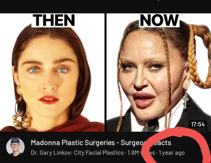Madonna's 2023 Grammy Awards face being used in 2022 video thumbnail - 9GAG
