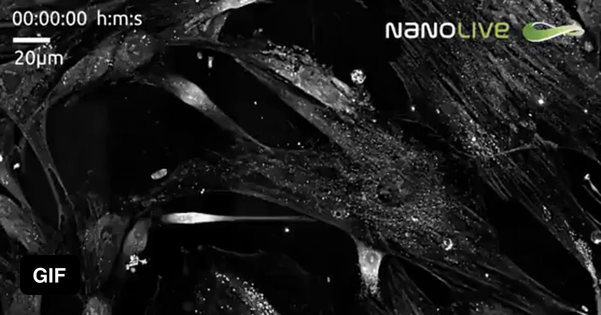 Birth of a brain cell. Stem cell differentiating into a neuron: - 9GAG