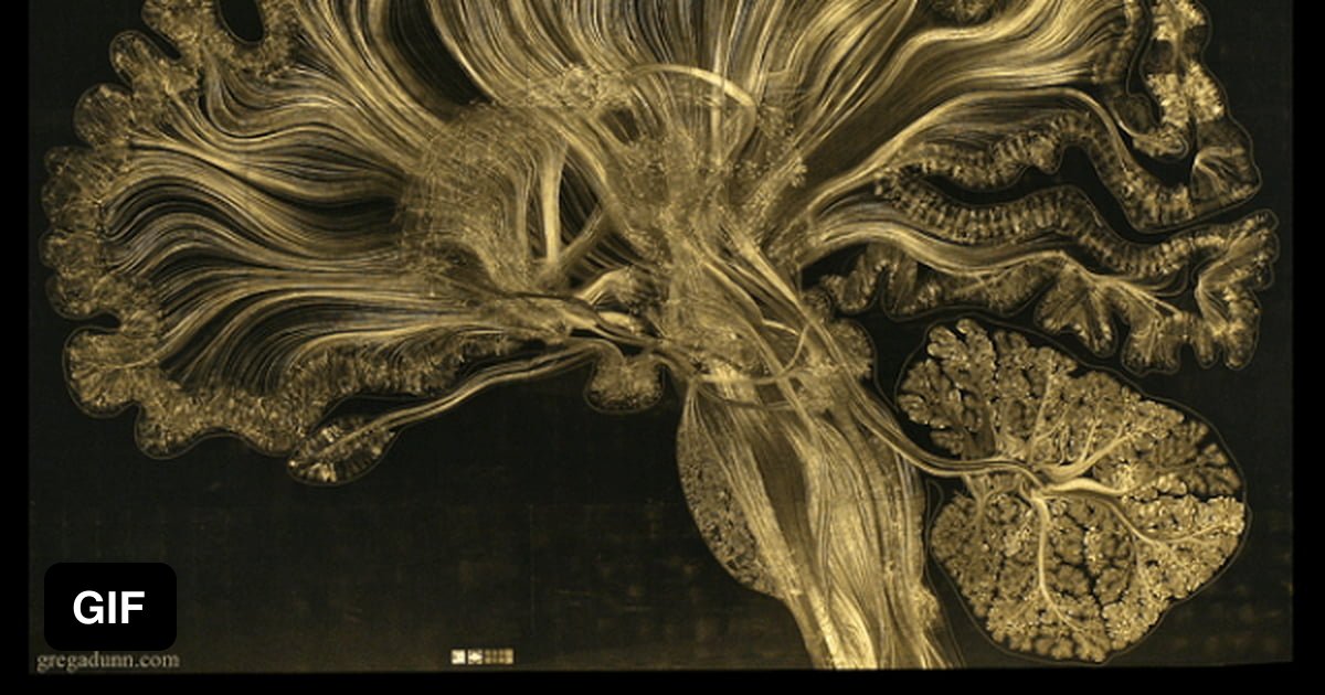 "Self Reflected" -- stunning neuro art by Dr. Greg Dunn (artist ...