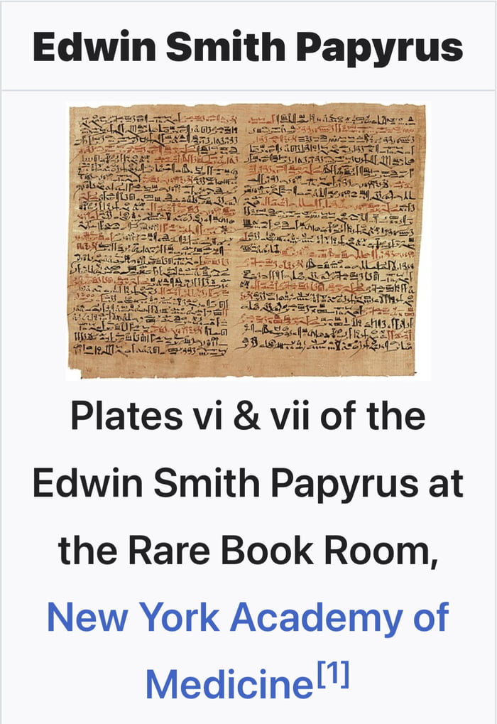 The Edwin Smith papyrus, c1600BC, is an (mostly)empirical, practical, rational text for medical ...