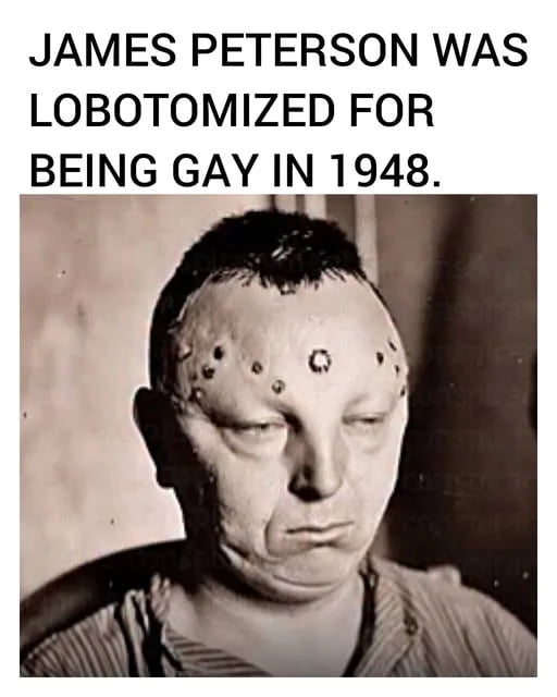 Lobotomy was invented in 1935–1936 by Portuguese neurologist Egas Moniz ...