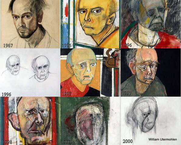 Meet American artist William Utermohlen. He was diagnosed with ...