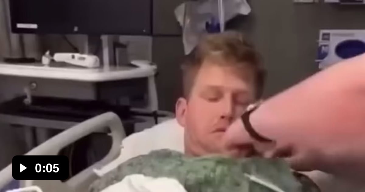 Half hairy half peacock - 9GAG