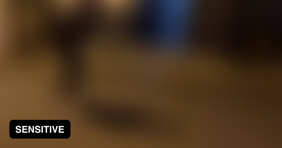 Attempting a backflip on the street gone wrong, ended up in the hospital - 9GAG