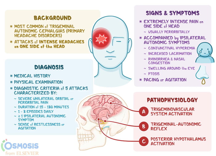 A cool guide about cluster headaches - 9GAG