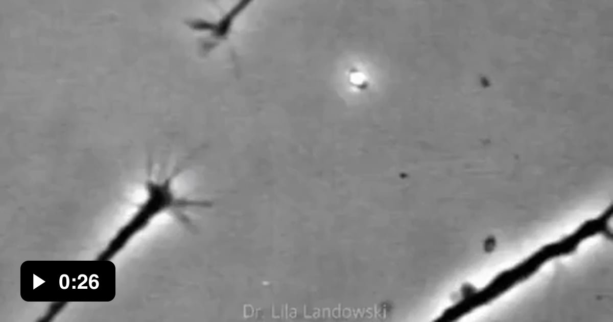 Two neurons are connecting together under microscope. - 9GAG