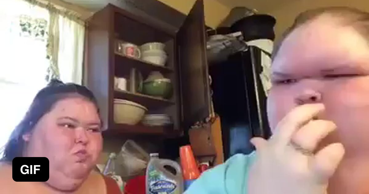 When you are so fat that your forehead stores fat - 9GAG