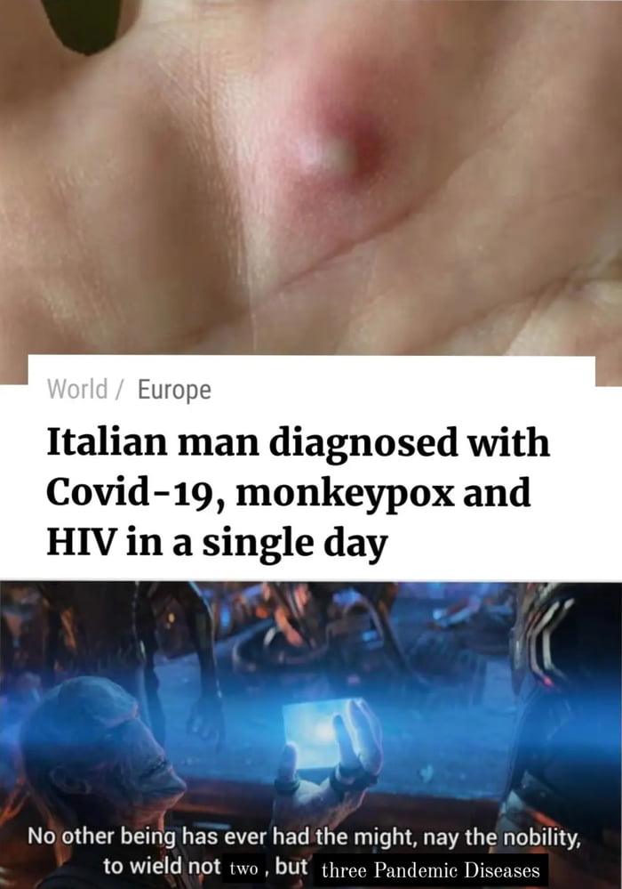 Infinity diseases - 9GAG