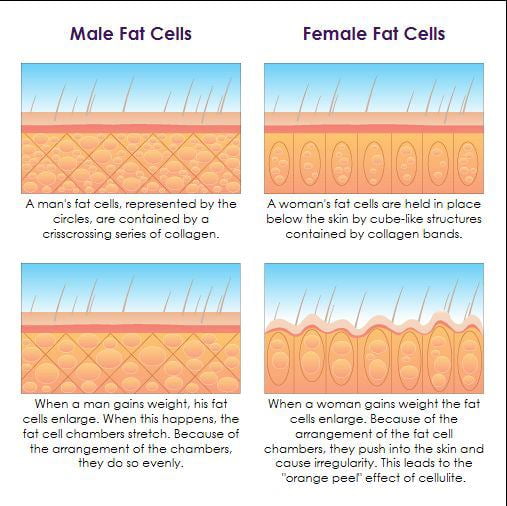 Cellulite in male vs female bodies - 9GAG