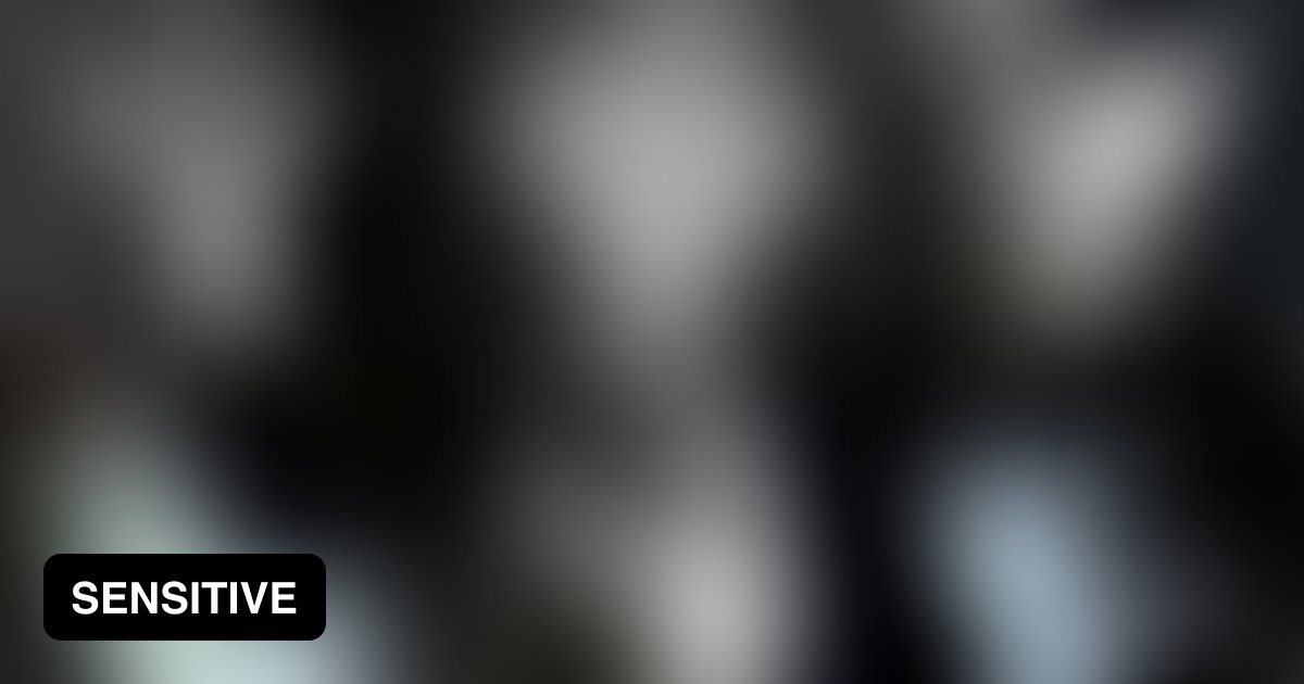 X-Rays of hands after firework accidents - 9GAG