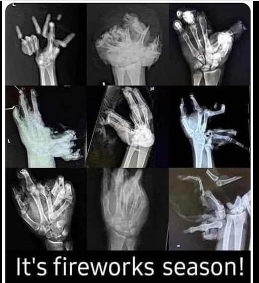 Firework aftermath xray - 9GAG