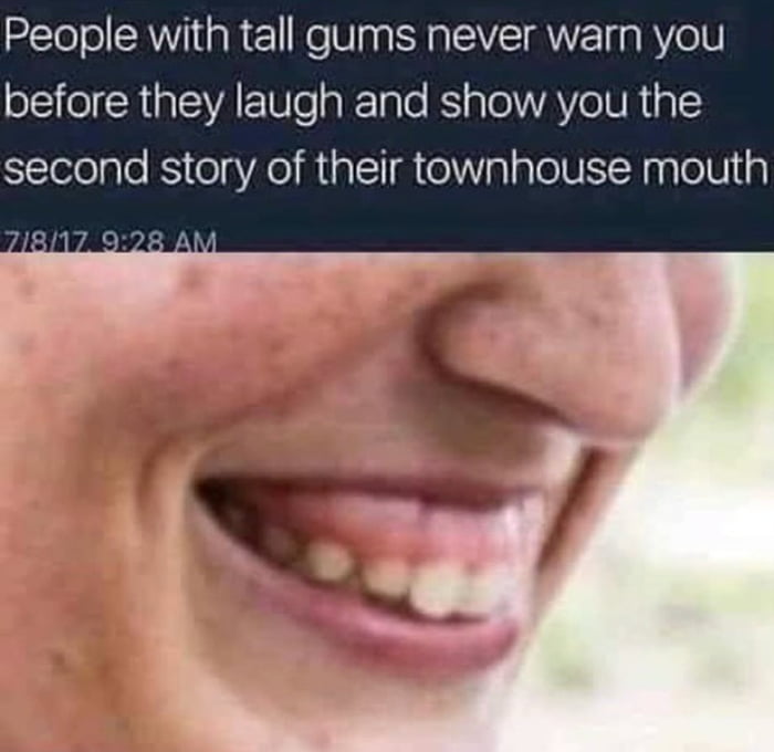 People with tall gums - 9GAG