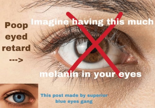 Imagine having poo eyes - 9GAG