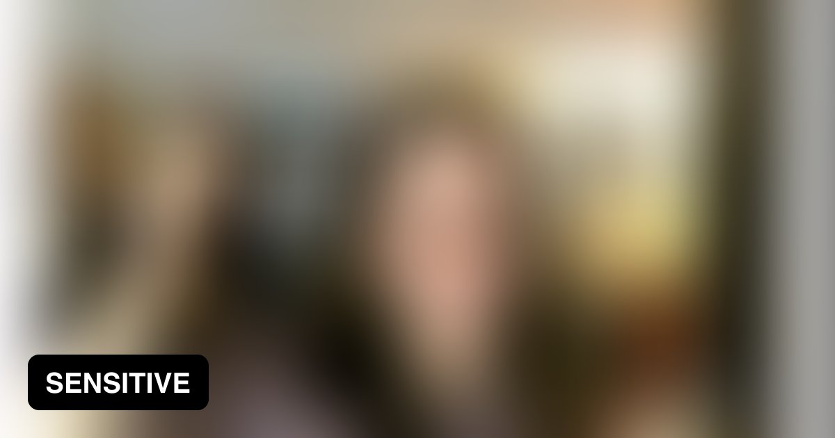 That forehead is a whole other dimension - 9GAG