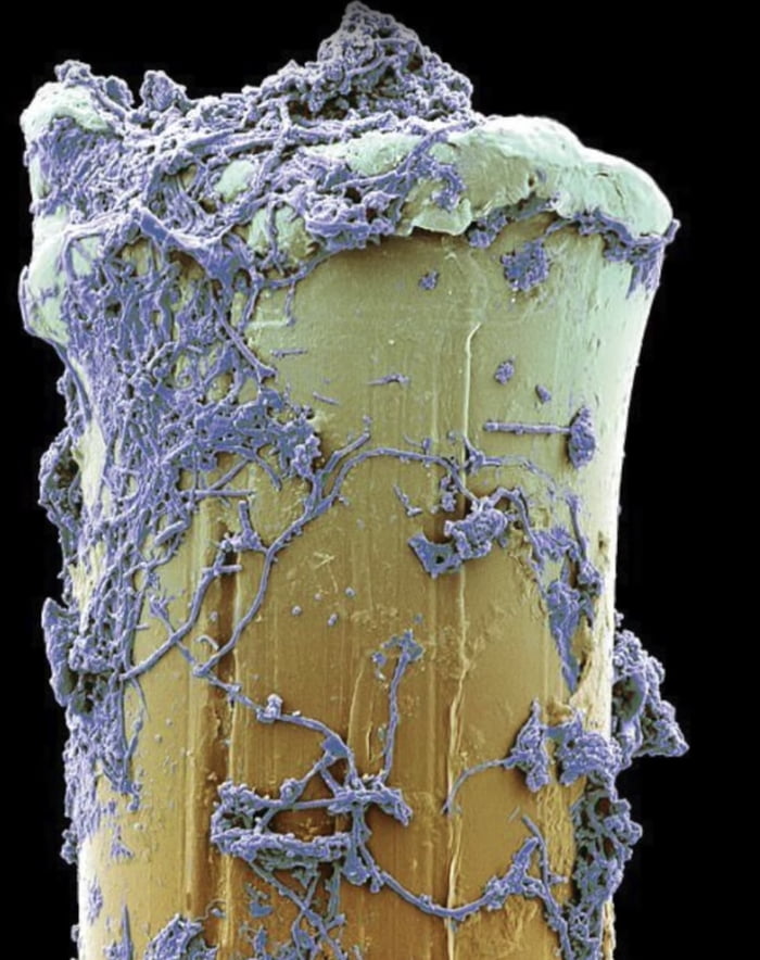 A single toothbrush bristle magnified 500 times - 9GAG