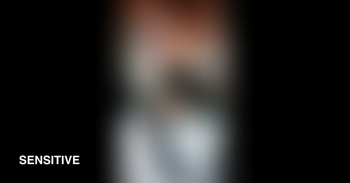 Kallie's lip slip - 9GAG