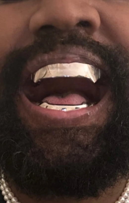 Kanye West new teeth - 9GAG