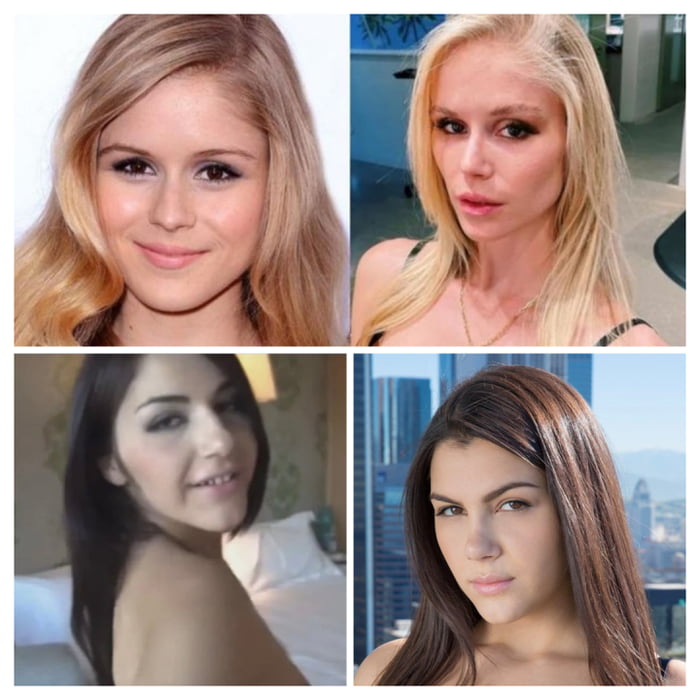 Plastic Surgery Fail vs Plastic Surgery Win - 9GAG