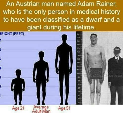 Adam Rainer, the Giant Dwarf - 9GAG