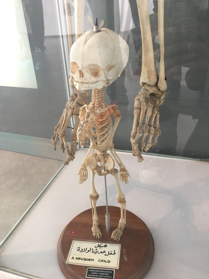 Real baby skeleton - 9GAG