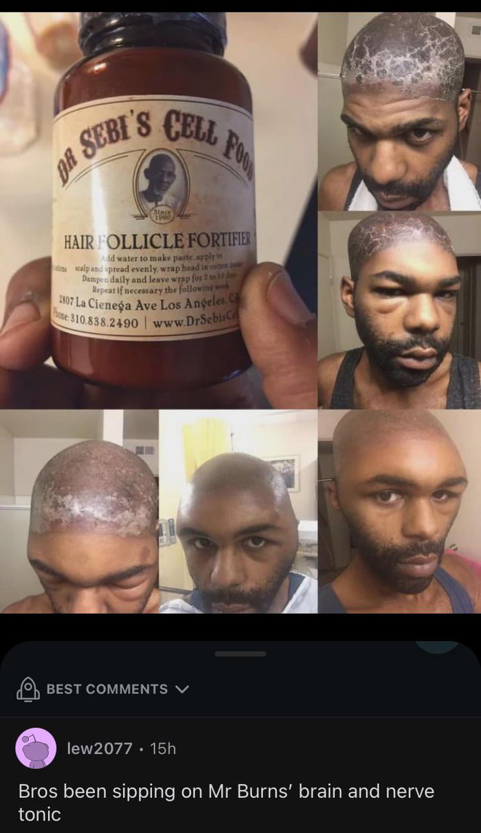 Brain and Nerve Tonic - 9GAG