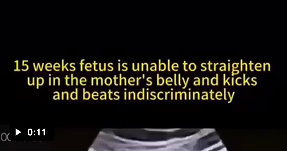 It looks like the fetus is throwing a temper tantrum - 9GAG