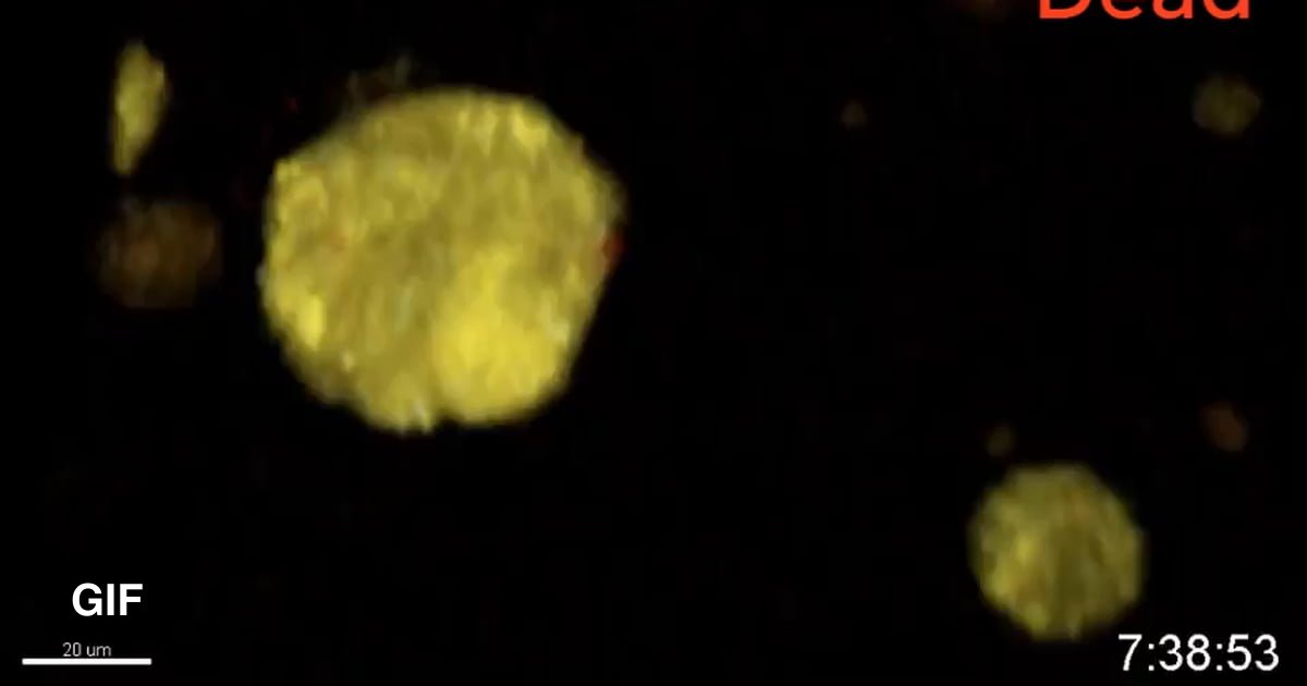 Killer T Cell Killing A Cancerous Cell see Comments For Sources 9GAG killer-t-cell-killing-a-cancerous-cell-see-comments-for-sources-9gag